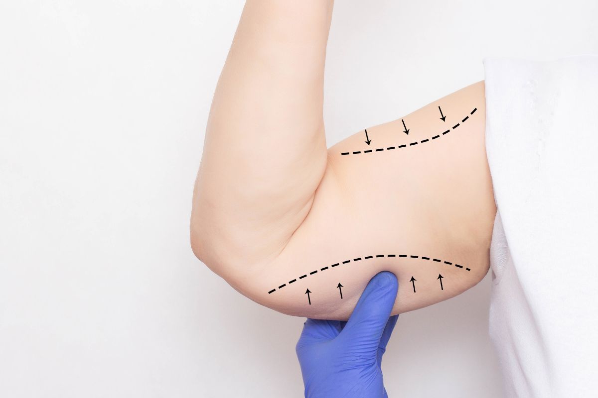 Bingo Wings - NU.U Clinic